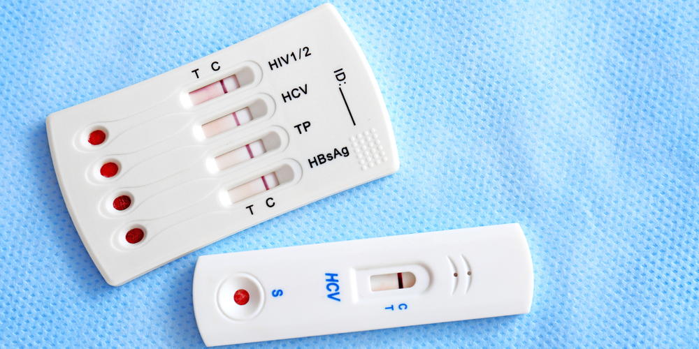 What Are Sexually Transmitted Diseases? How to Use STDs Rapid Test Kit?